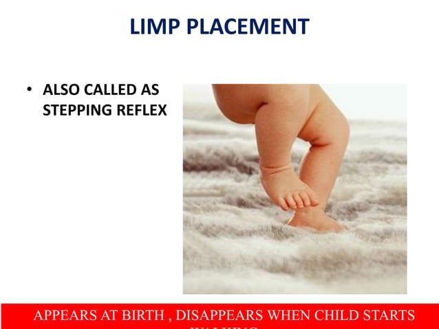 ASSESSMENT OF NEWBORN REFLEXES | PPTX