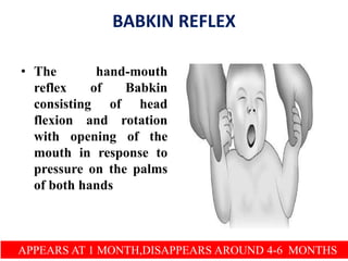 ASSESSMENT OF NEWBORN REFLEXES | PPTX
