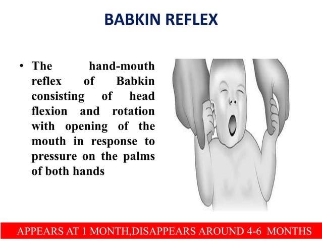 ASSESSMENT OF NEWBORN REFLEXES | PPTX
