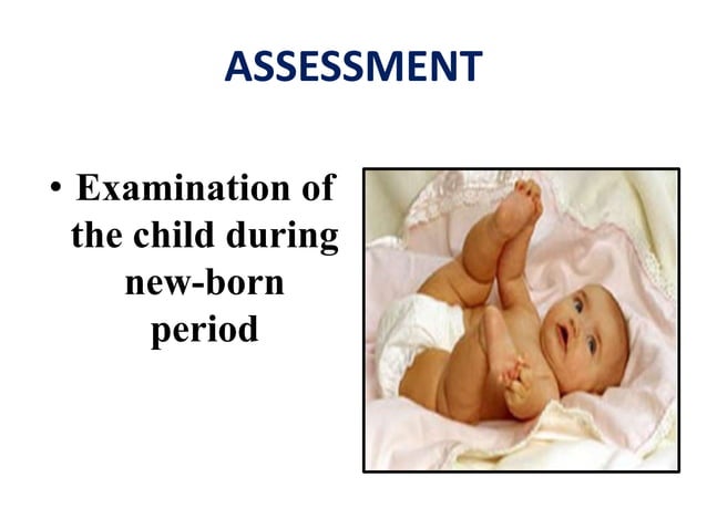ASSESSMENT OF NEWBORN REFLEXES | PPTX