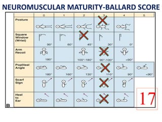 Infant Reflexes Chart