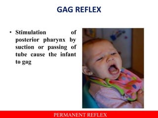 Gag Reflex Baby