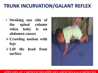 ASSESSMENT OF NEWBORN REFLEXES | PPT
