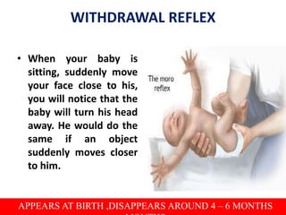 Flexor Withdrawal Reflex Baby