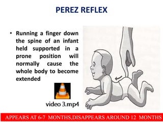 ASSESSMENT OF NEWBORN REFLEXES | PPT