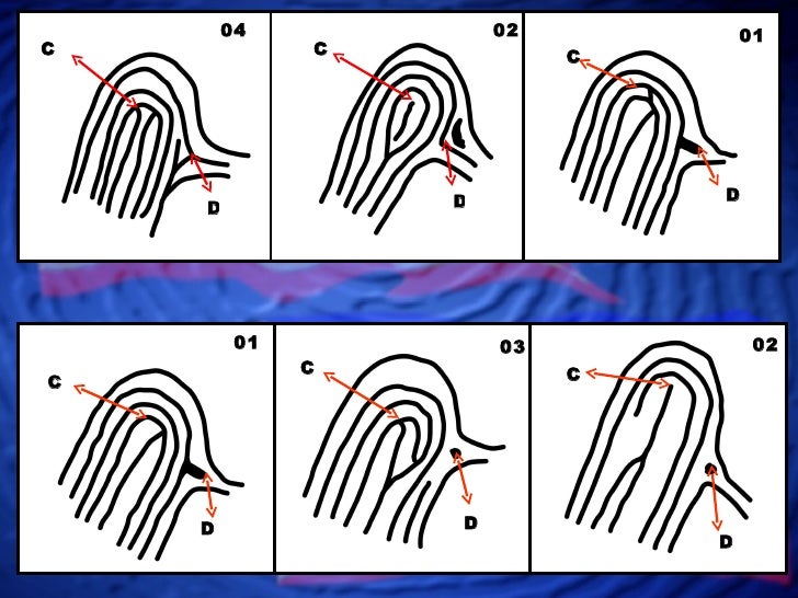 Fingerprint Classification- slide 1