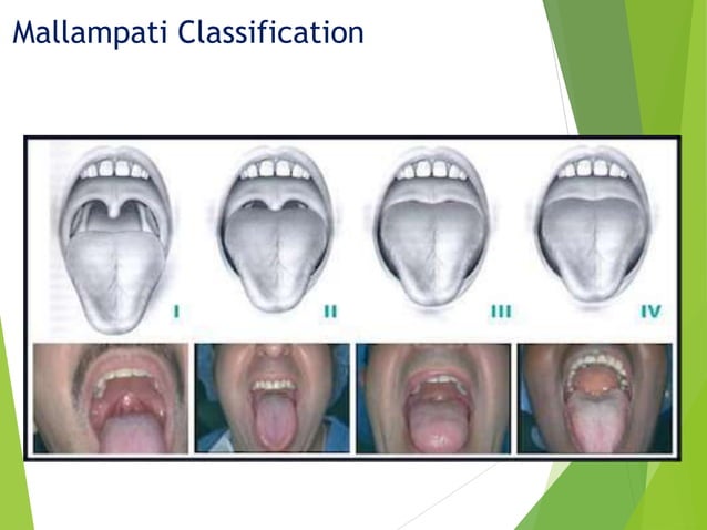 1b general anesthesia | PPT