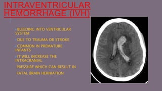 BRAIN INJURIES IN CT | PPTX