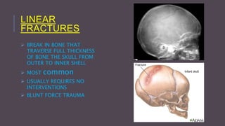 BRAIN INJURIES IN CT | PPTX