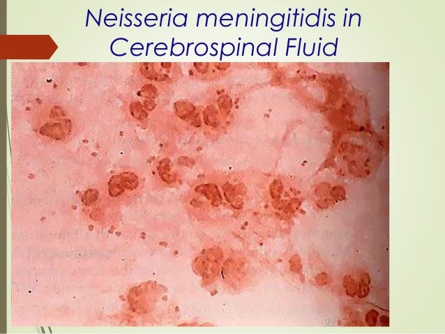 Bacterial meningitis