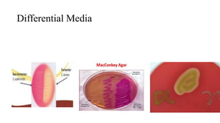Bacteriological Media | PPTX
