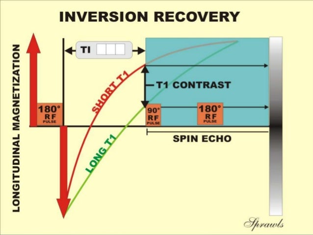 Basic Pulse Sequences In MRI