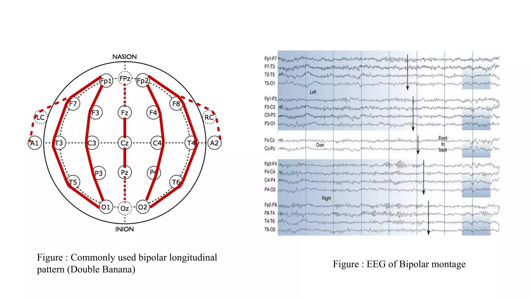 1 basics of eeg and fundamentals of its measurement | PPTX | Brain and ...