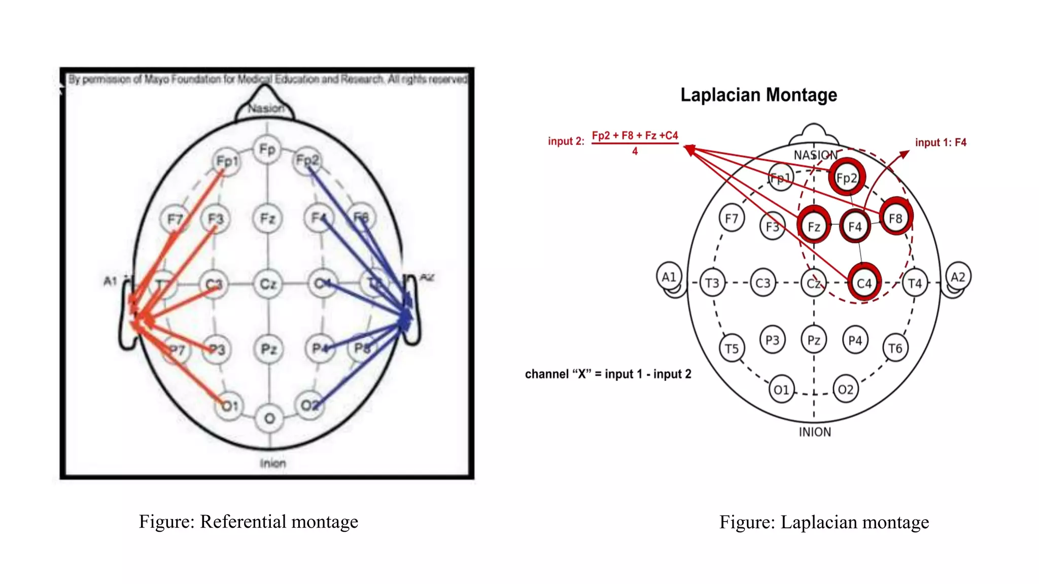 1 basics of eeg and fundamentals of its measurement | PPT