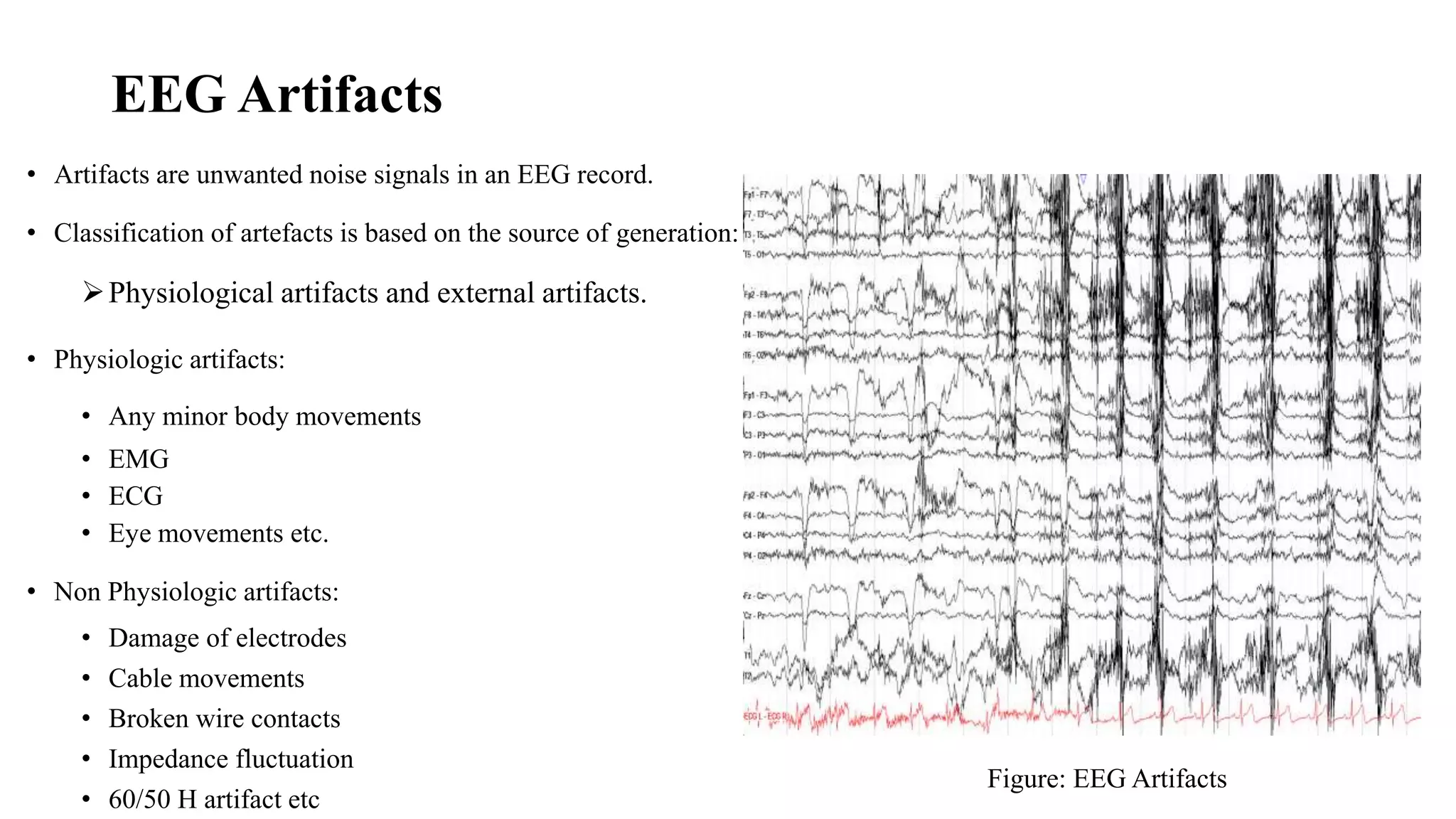 1 basics of eeg and fundamentals of its measurement | PPTX