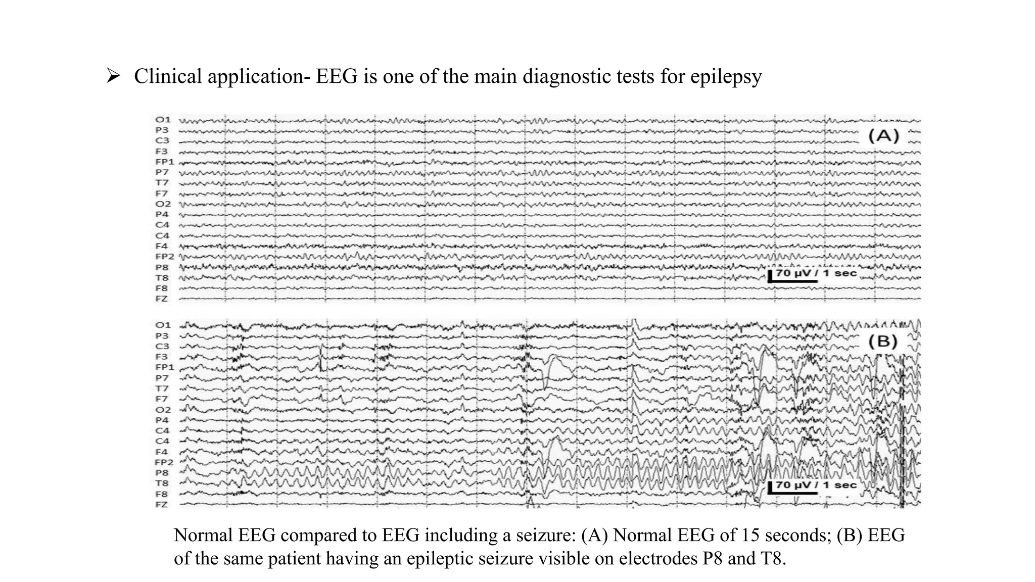 1 basics of eeg and fundamentals of its measurement | PPTX