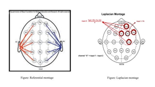 1 basics of eeg and fundamentals of its measurement | PPT