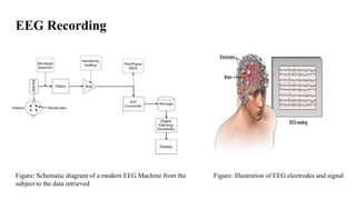 1 basics of eeg and fundamentals of its measurement | PPTX
