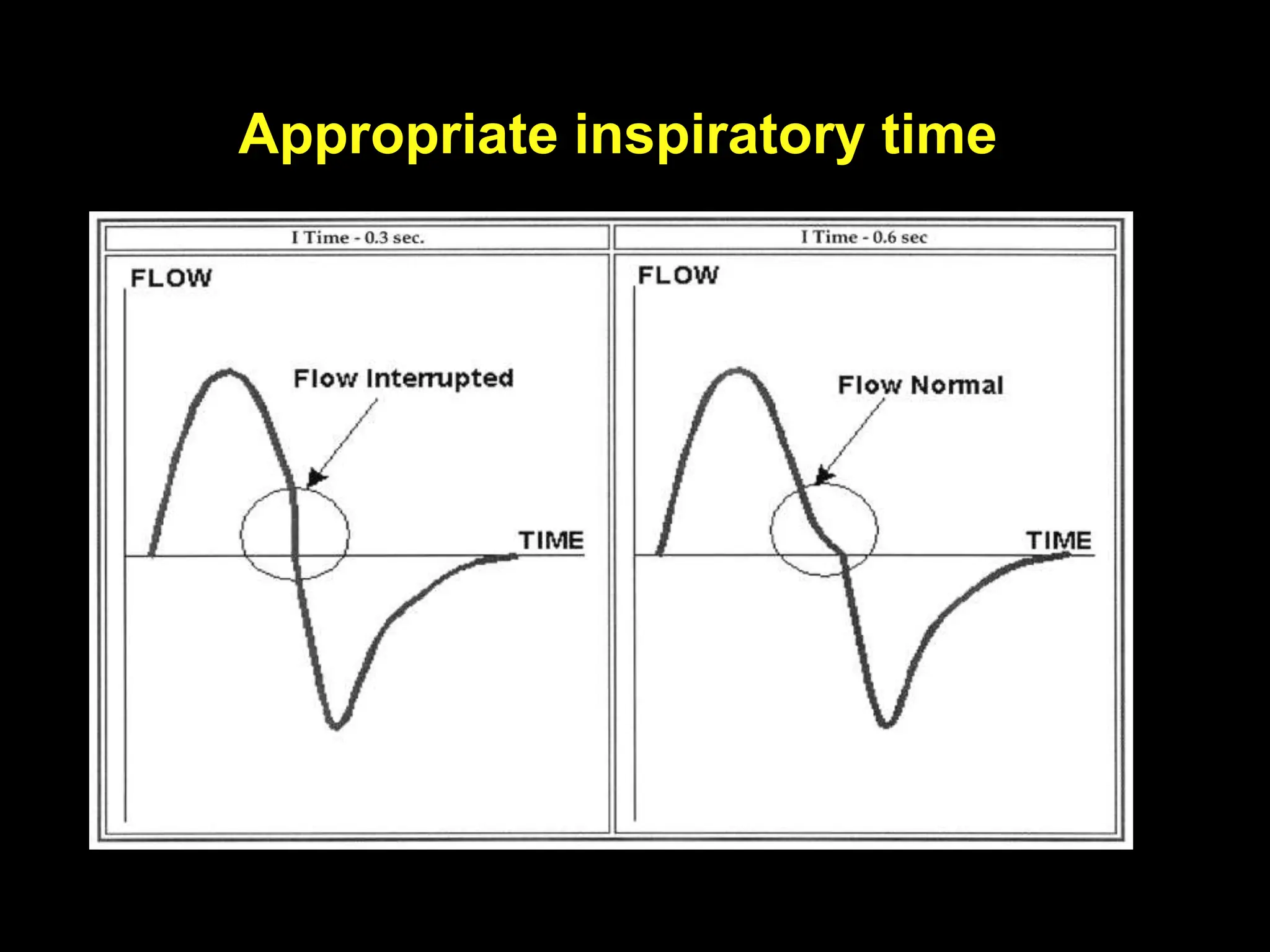1) Basics on mechanical ventilation (1).ppt