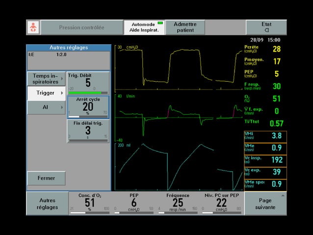 1) Basics on mechanical ventilation (1).ppt