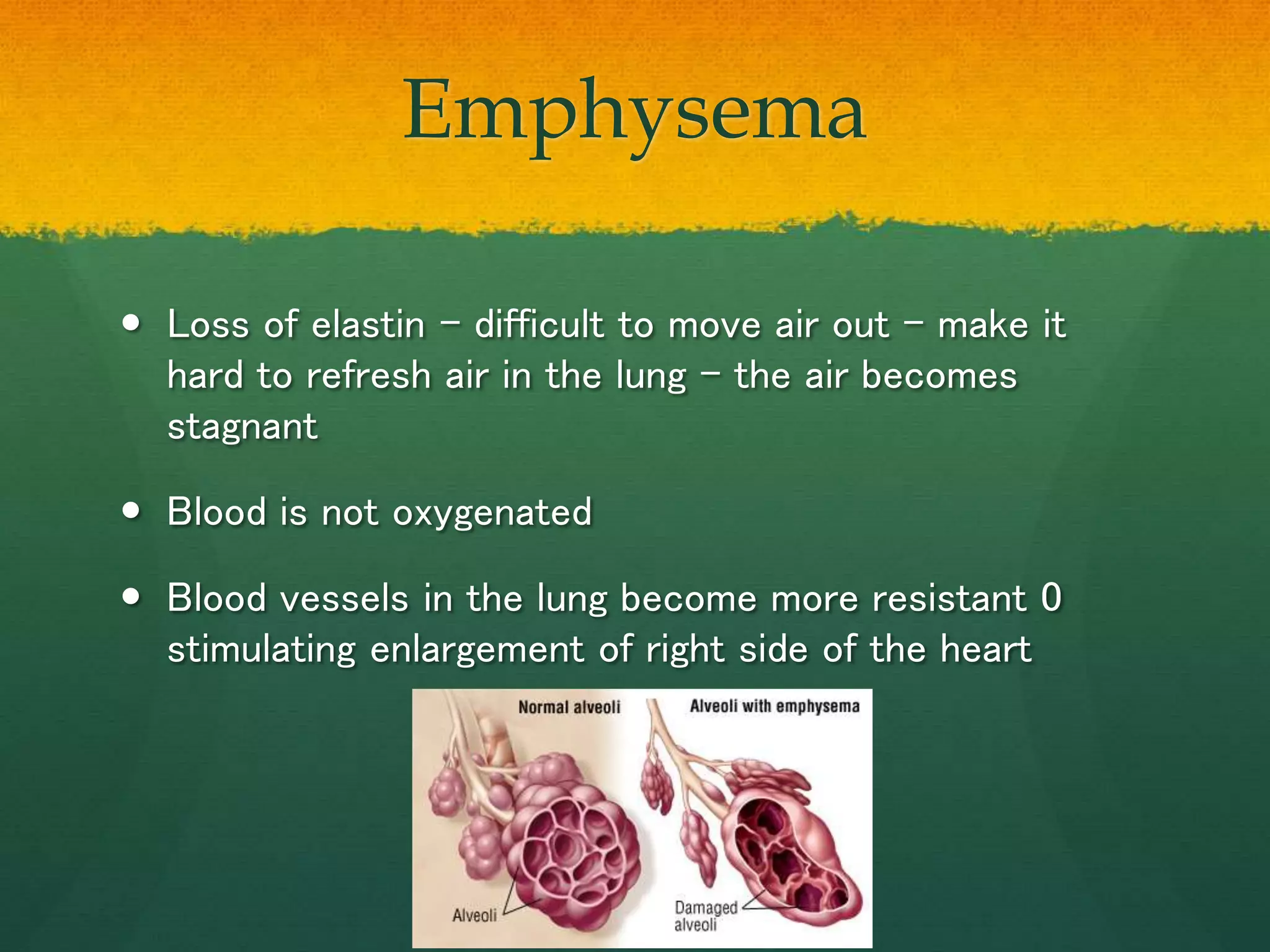 AS Level Biology - 9) Gas Exchange | PPTX