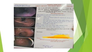 mẫu bệnh án hscc chống độc bạch mai .pptx