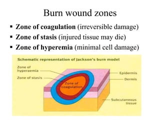 1 Burn rehablitation.pptx