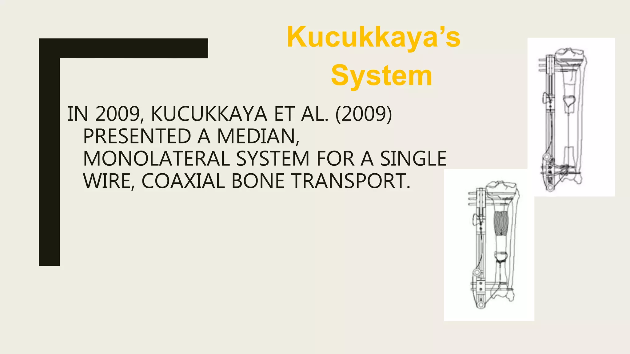 Cable techniques for bone transport in massive bone defects #dr_azanki ...