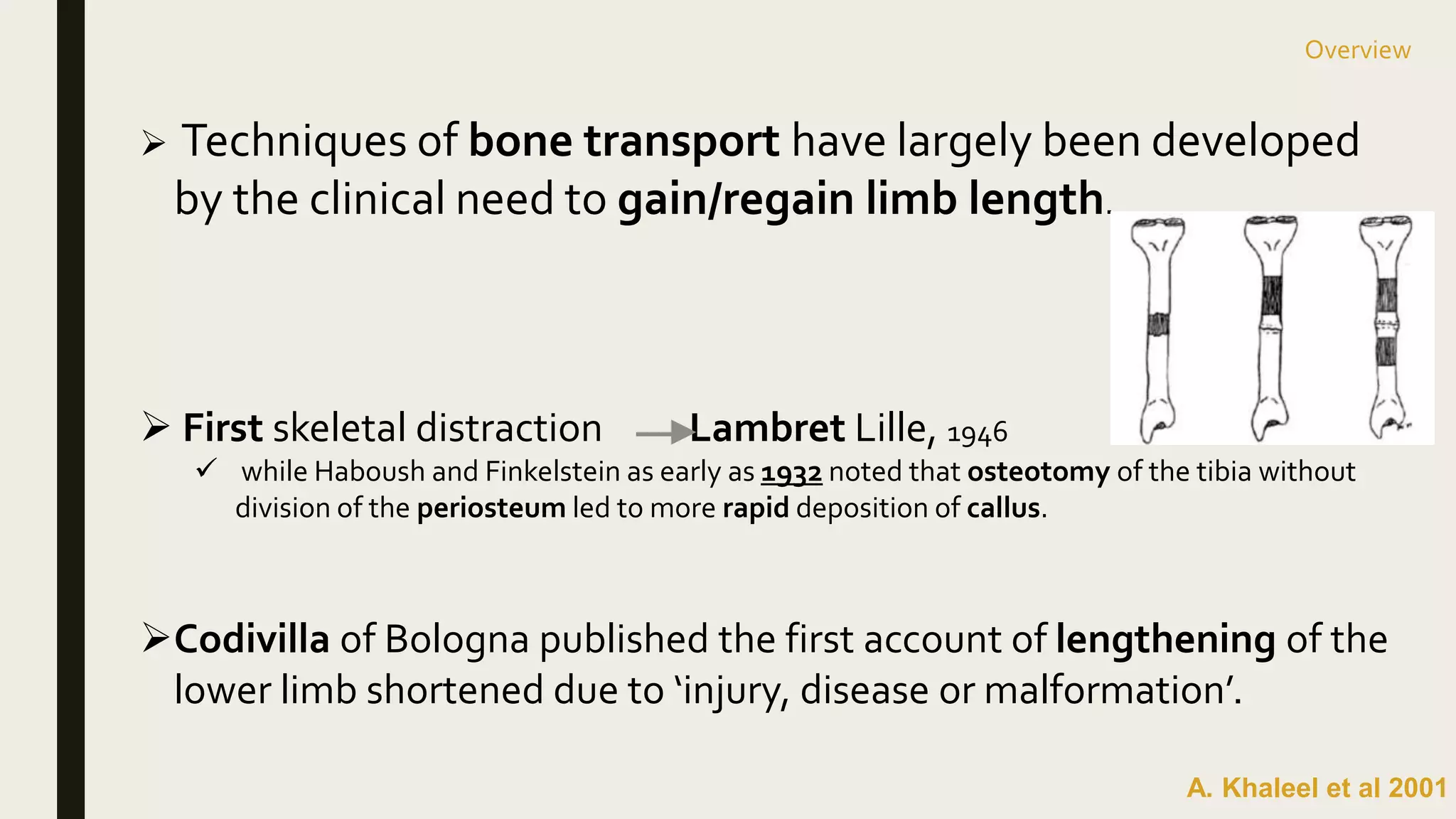 Cable techniques for bone transport in massive bone defects #dr_azanki ...