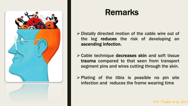 Cable techniques for bone transport in massive bone defects #dr_azanki ...