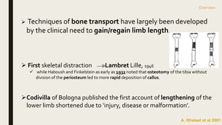 Cable techniques for bone transport in massive bone defects #dr_azanki ...