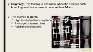 Cable techniques for bone transport in massive bone defects #dr_azanki ...