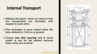 Cable techniques for bone transport in massive bone defects #dr_azanki ...