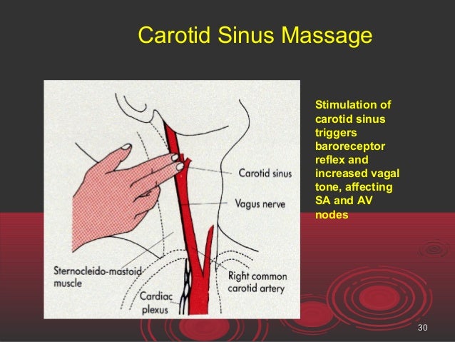 Cardiac Arrhythmias
