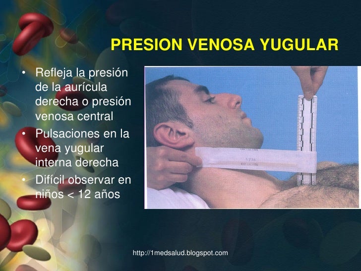 CORAZON | Exploracion Cardiaca..Enter