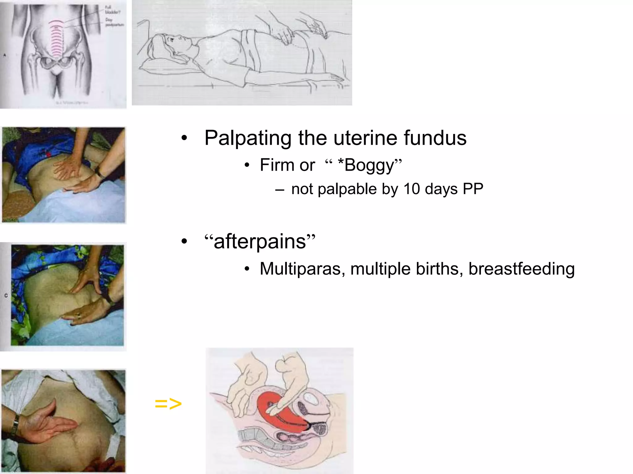 1 care of postpartum | PPTX