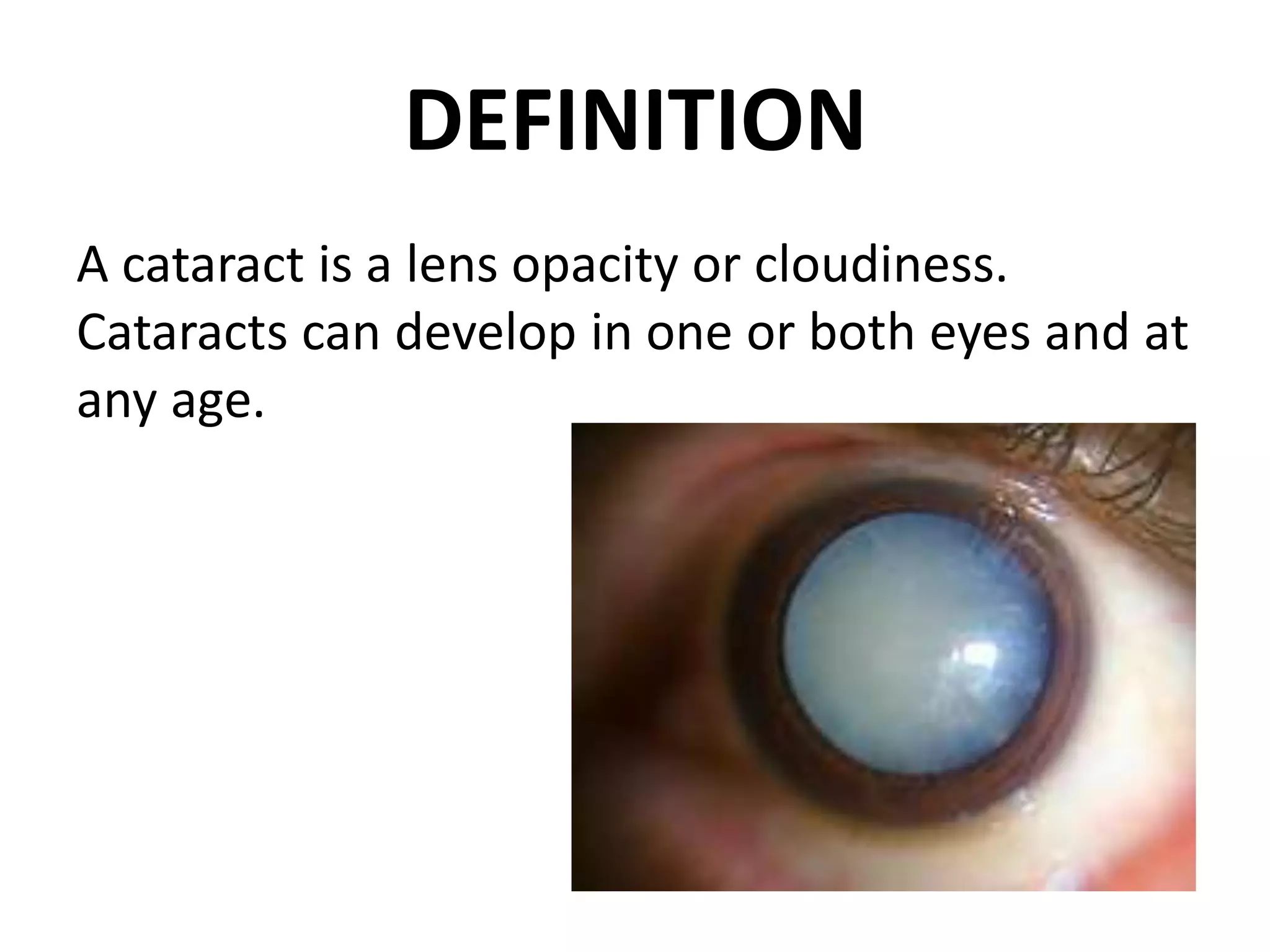 Cataract - Easy PPT for Nursing Students | PDF