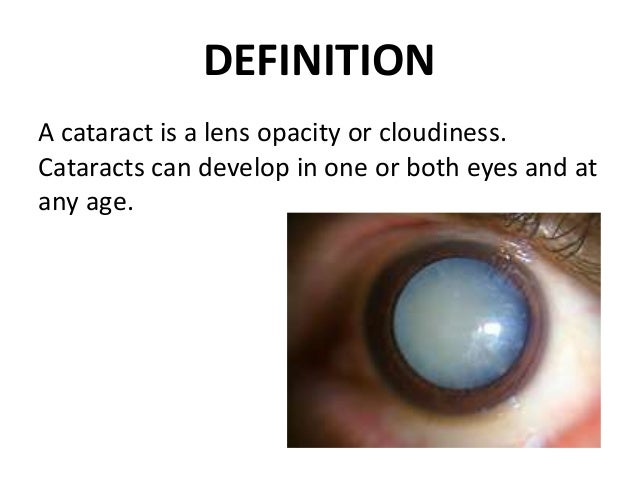 Cataract - Easy PPT for Nursing Students