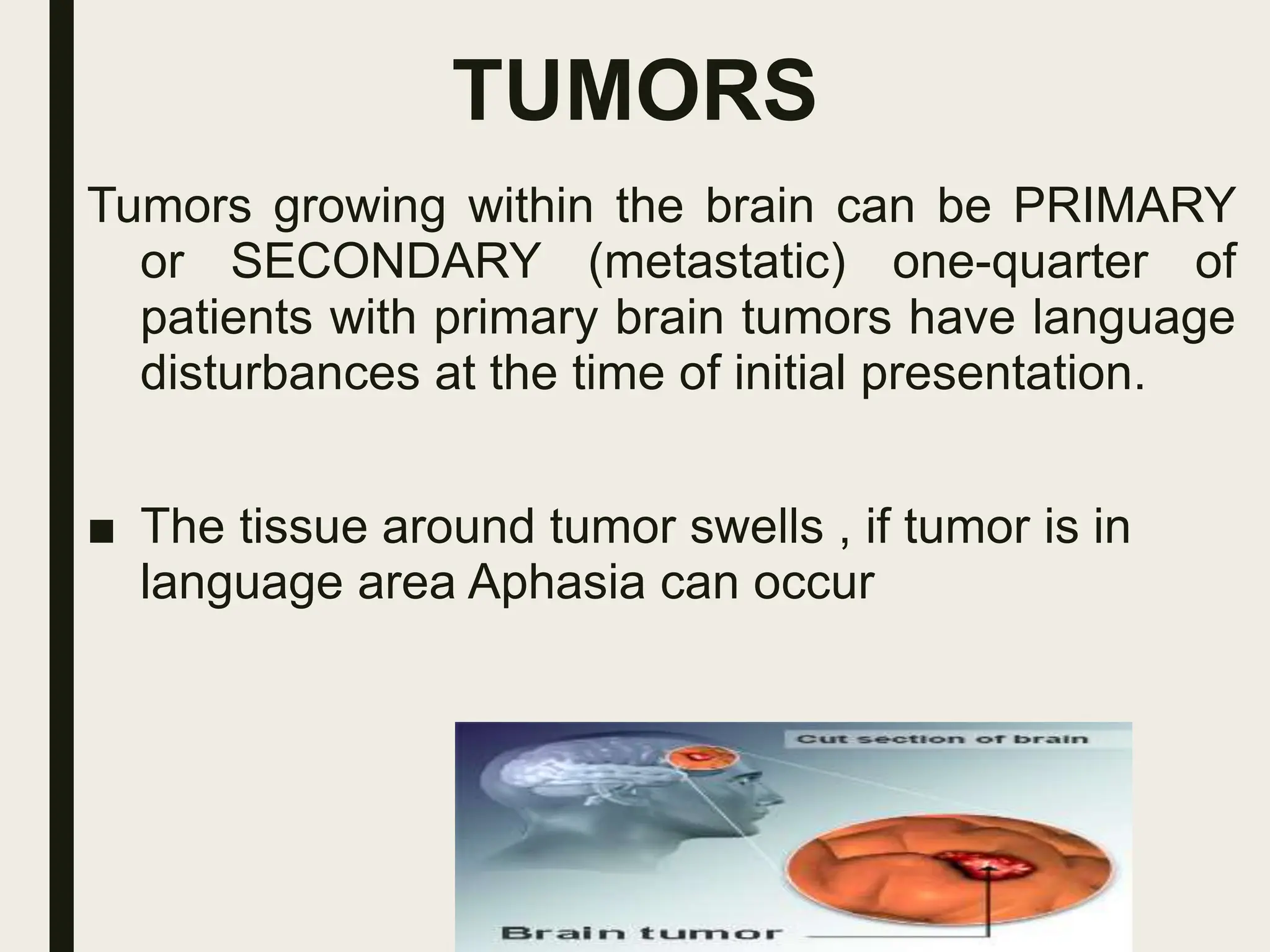 1 Causes of Acquired Language Disorders.pptx