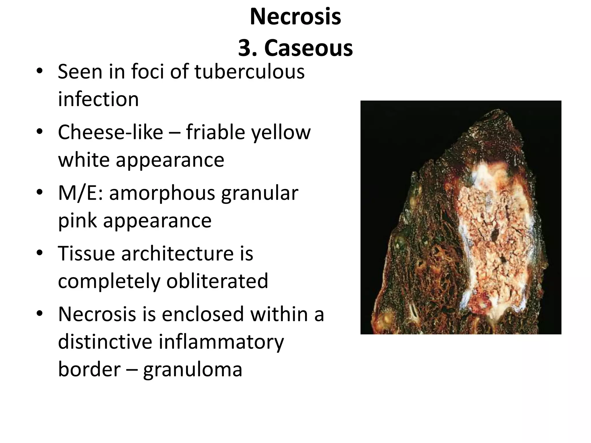 Cell injury, Cell Death and Adaptation.ppt