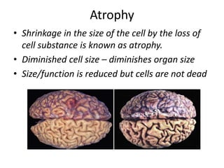 Cell injury, Cell Death and Adaptation.ppt