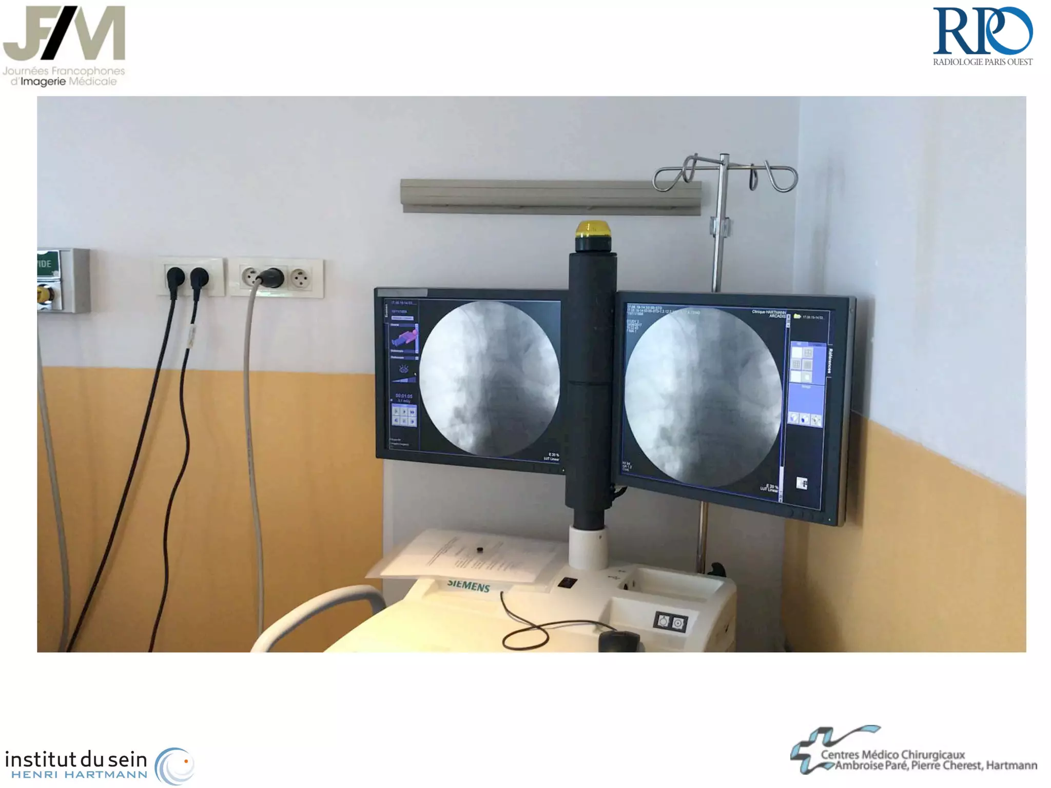 Chest port implant access and techniques. Luc Rotenberg 2018 | PPT