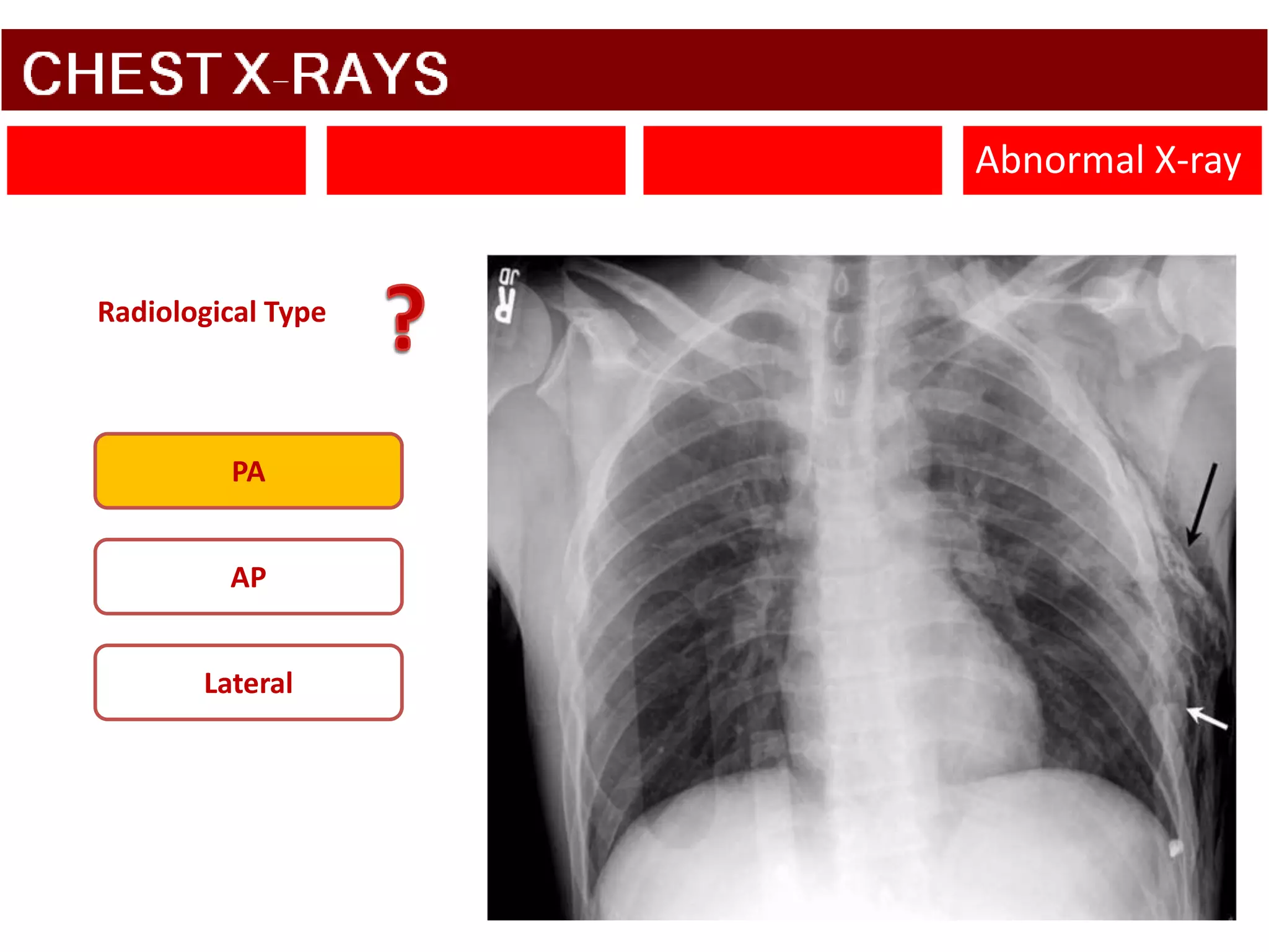 1 Chest X rays.pptx