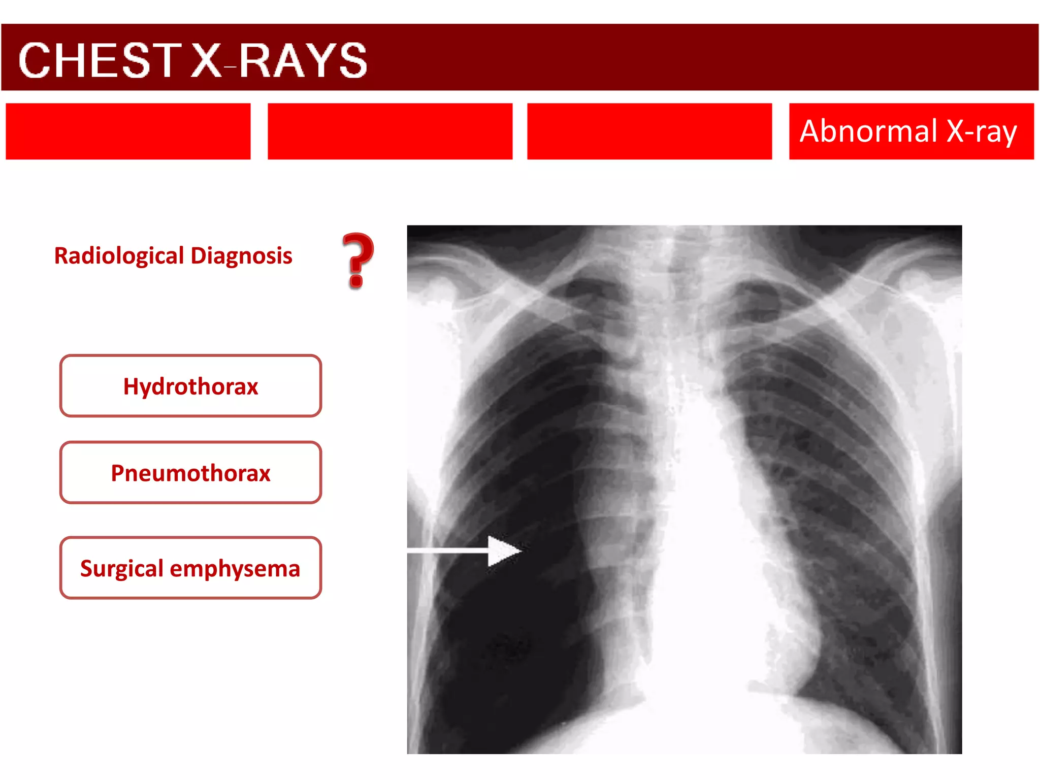 1 Chest X rays.pptx