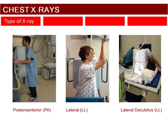 1 Chest X rays.pptx