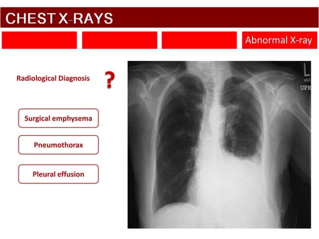 1 Chest X rays.pptx