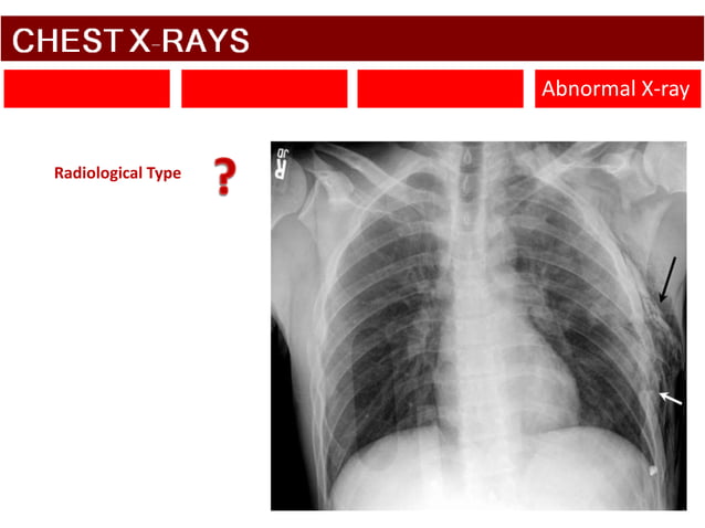 1 Chest X rays.pptx