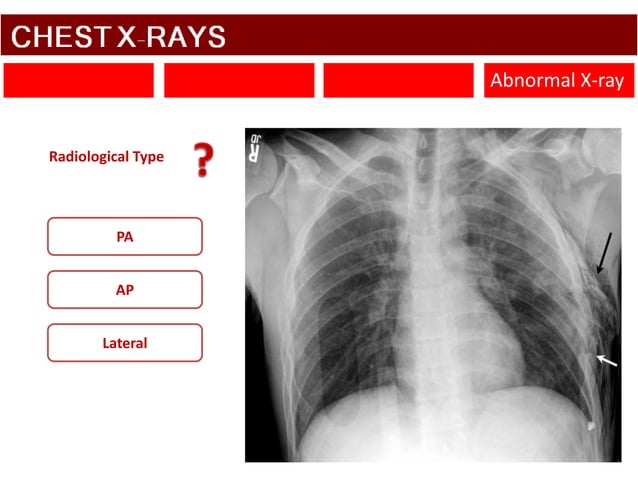 1 Chest X rays.pptx