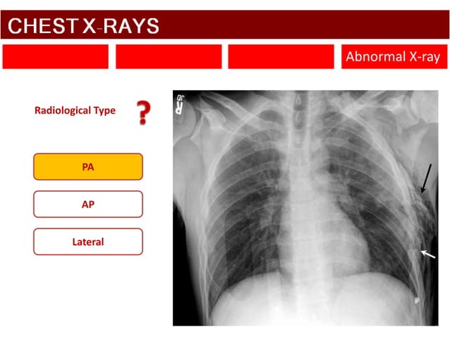 1 Chest X rays.pptx