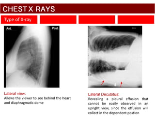 1 Chest X rays.pptx
